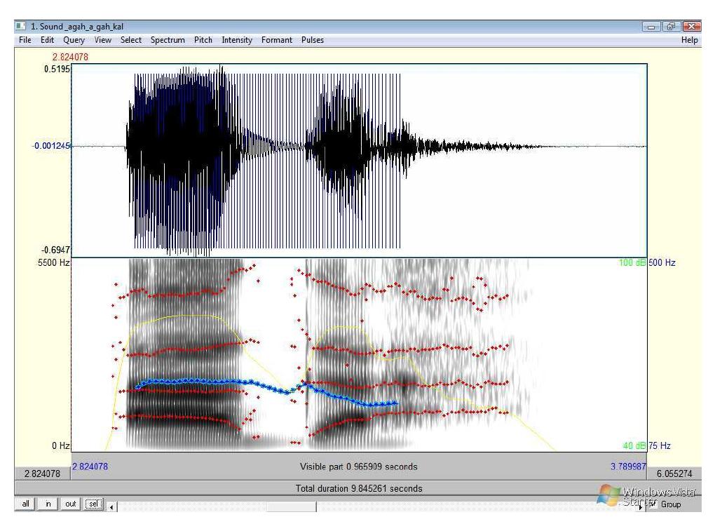 Formant Measurement Of Vowels Following The Consonants K