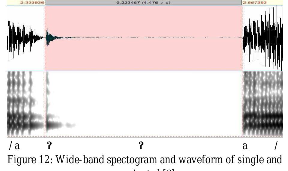 Figure 15 - The Phonetic Structures of Kalanguya