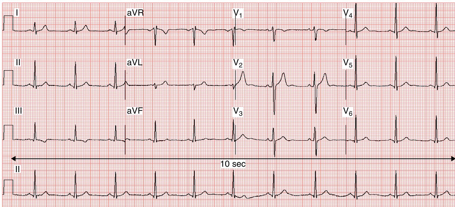 -15. quick methods to measure heart rate. shown is standard