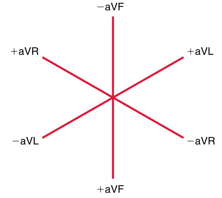 -6. triaxial lead diagram showing the relationship of the