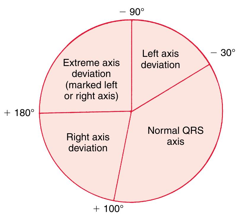 -13. normal qrs axis and axis deviation. most ecgs show