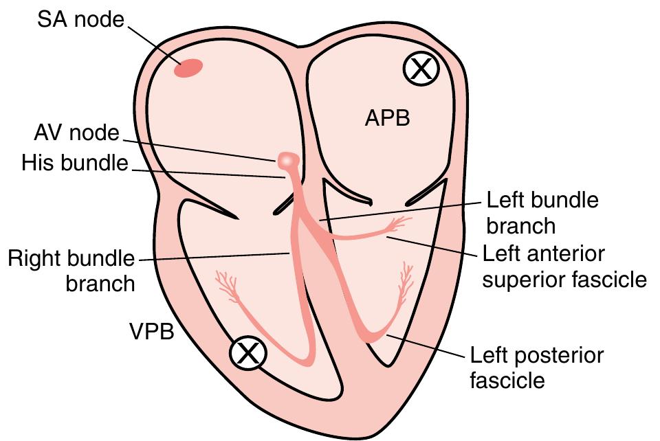 -8. difference between noncompensatory and compensatory