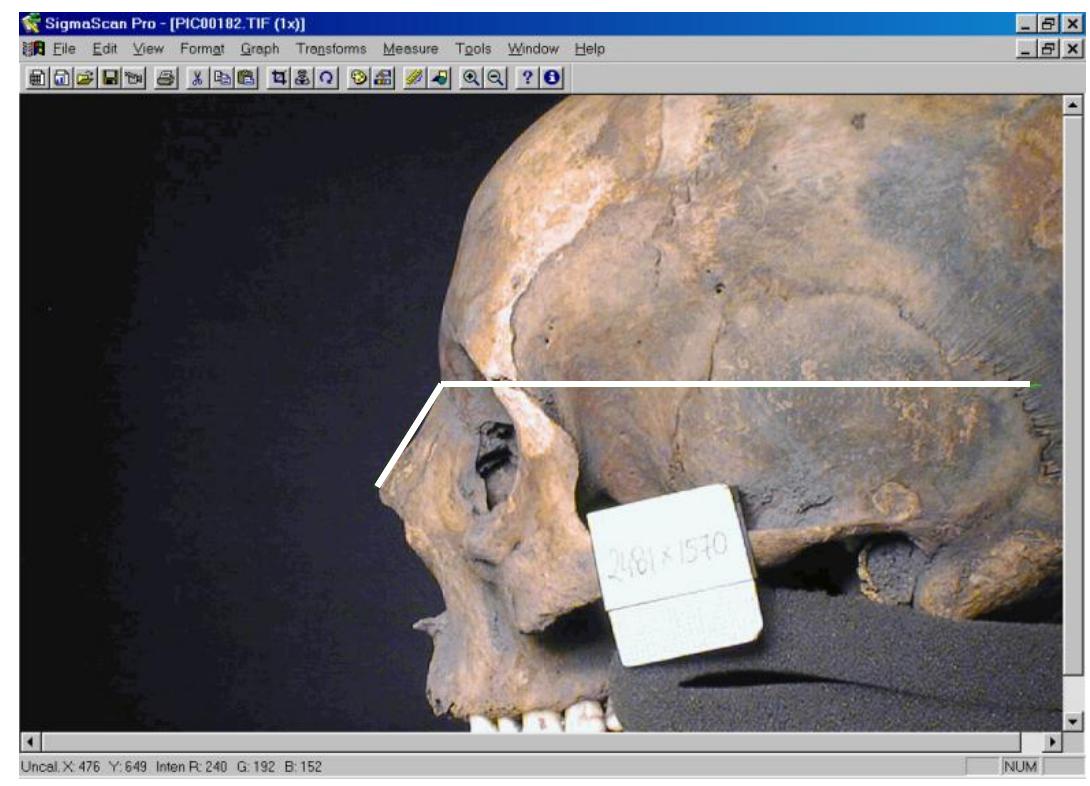 Measuring the nasal protrusion in sigmascan® pro software