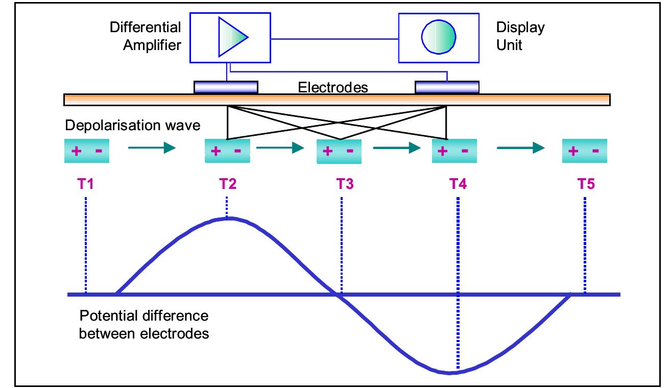 (PDF) ABC of EMG