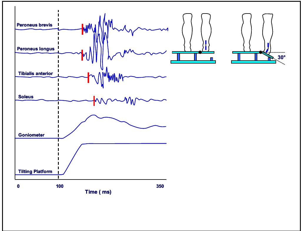Emg onset analysis on a tilting platform. the reflex induced