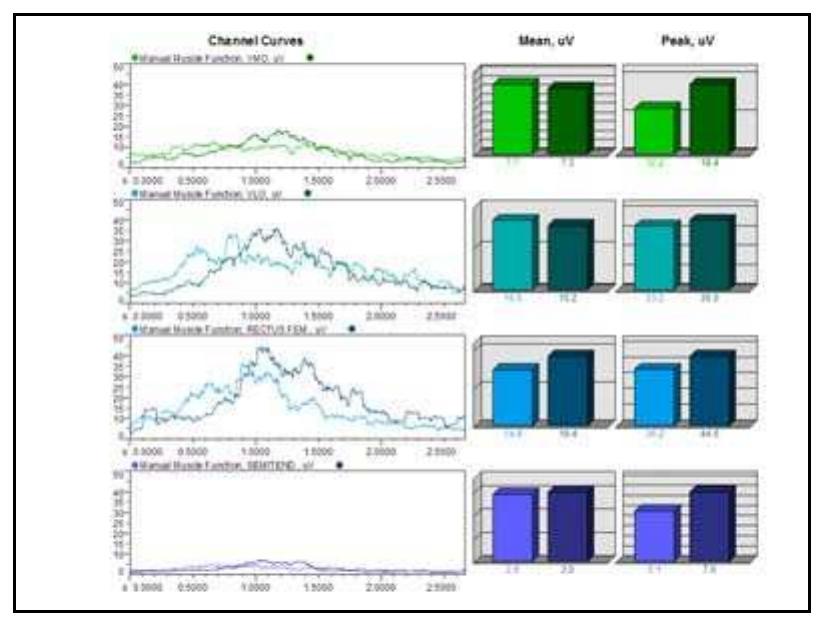 Easy comparison analysis: two signal portions (e.g. from