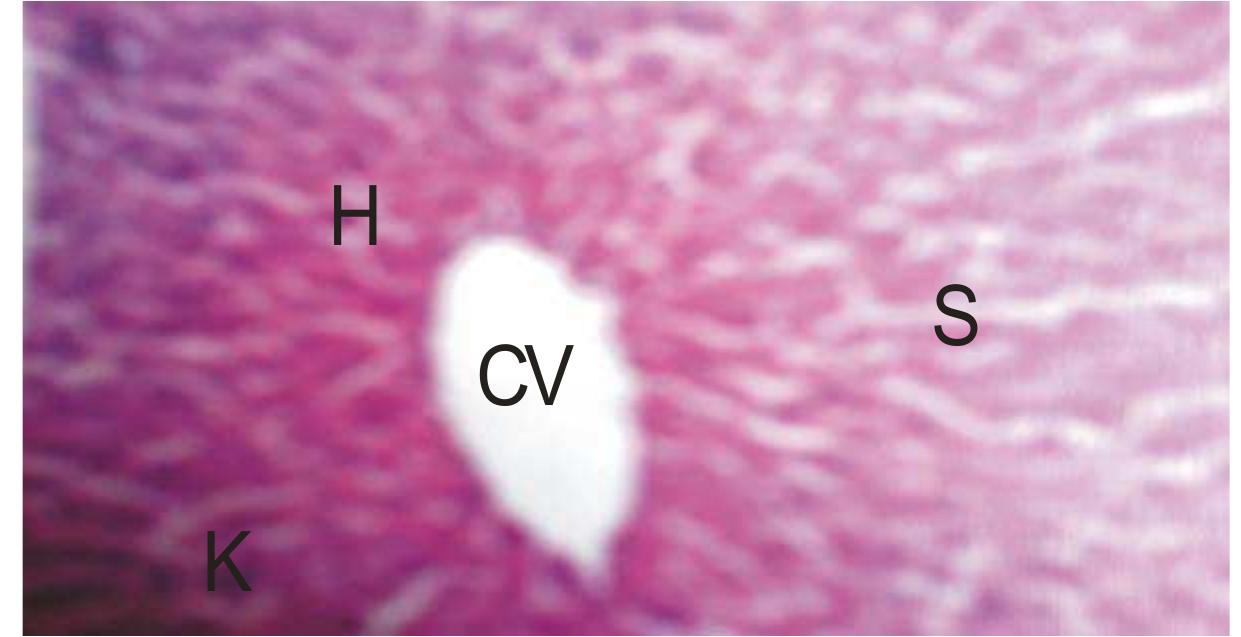 Photomicrograph of transverse section of normal liver