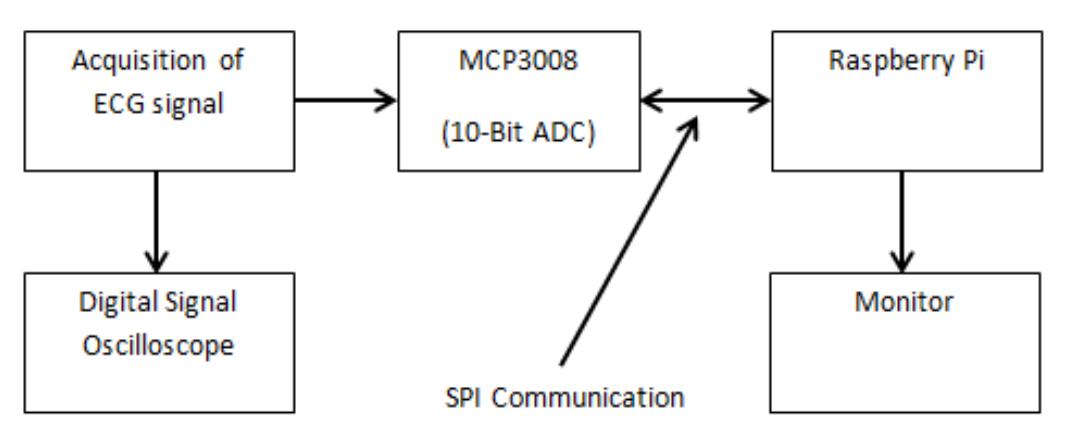 Block diagram of ecg monitoring system block diagram of ecg