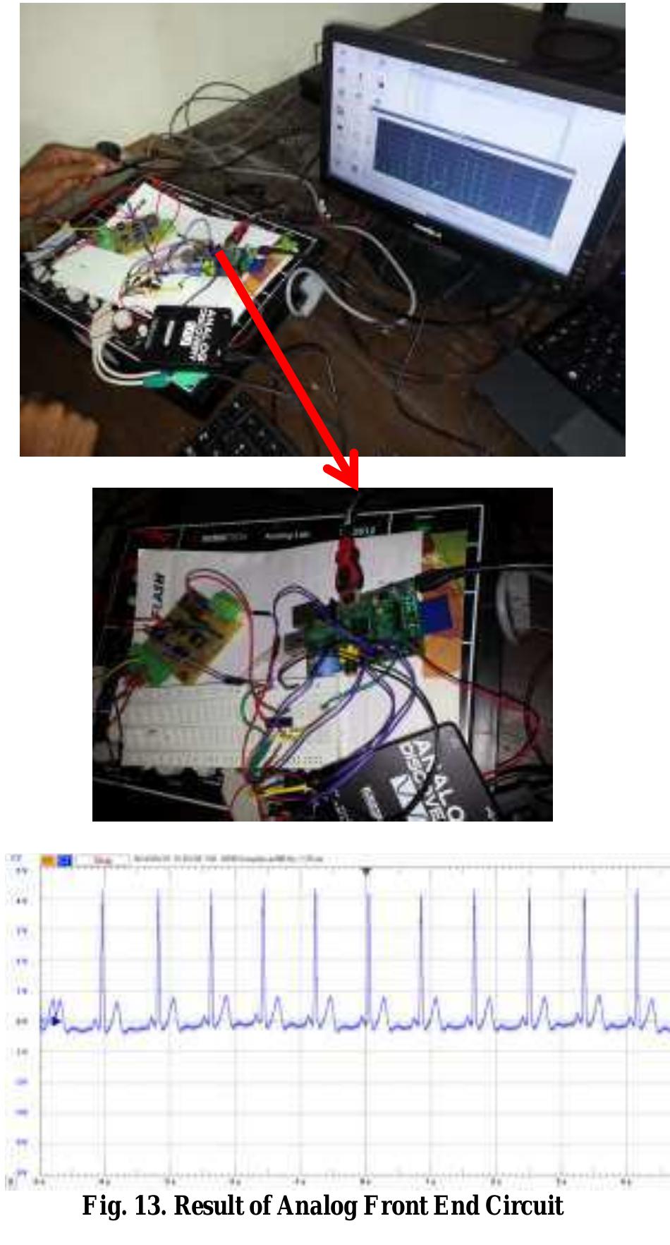 Figure 9 - Real Time ECG Acquisition System using Raspberry