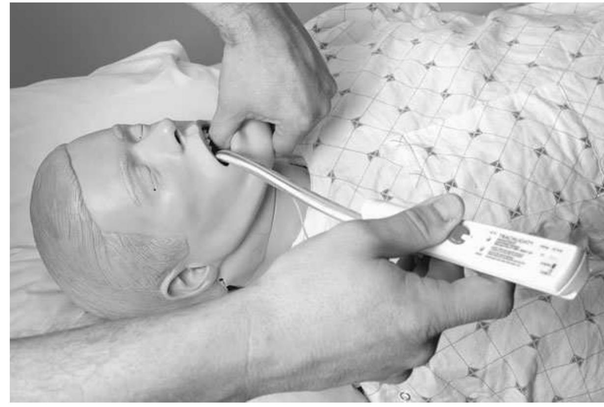 -21. trachlight insertion is with a jaw lift, from the side