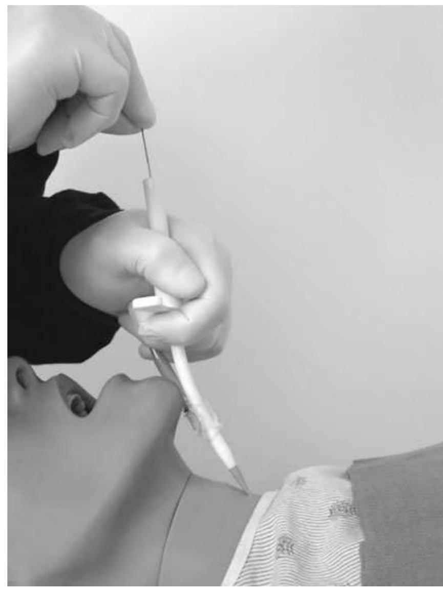 -22. holding the cannula and curved dilator together, the