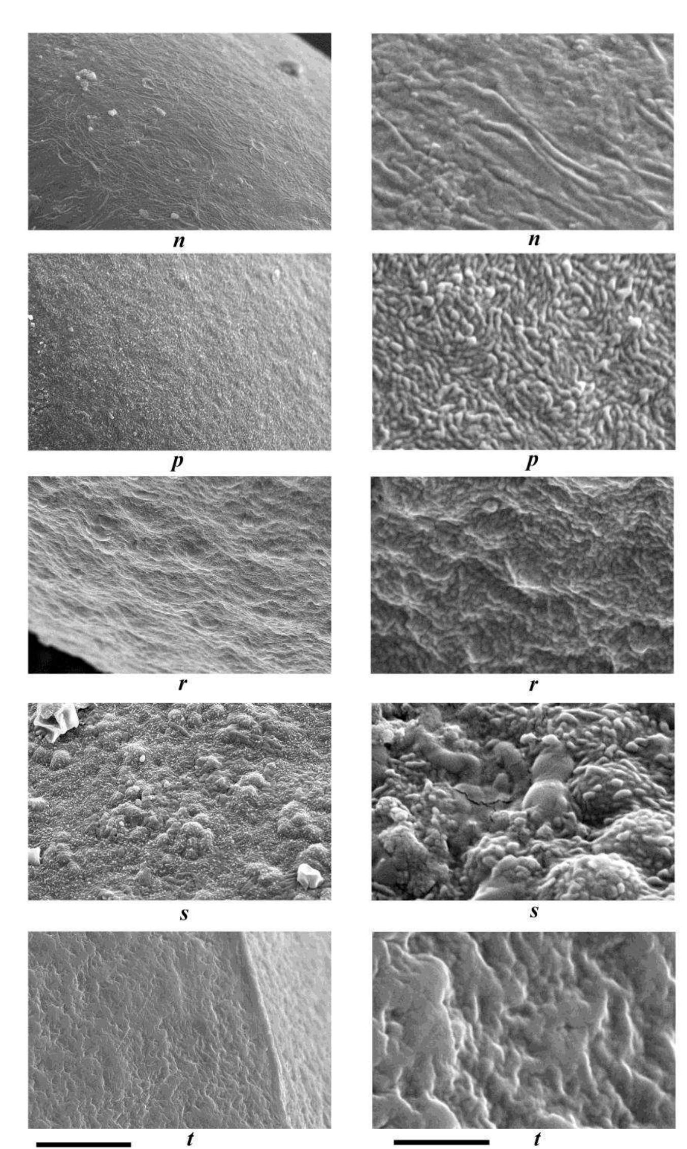 Morphotypes of the cyst chorion surface in artemia from
