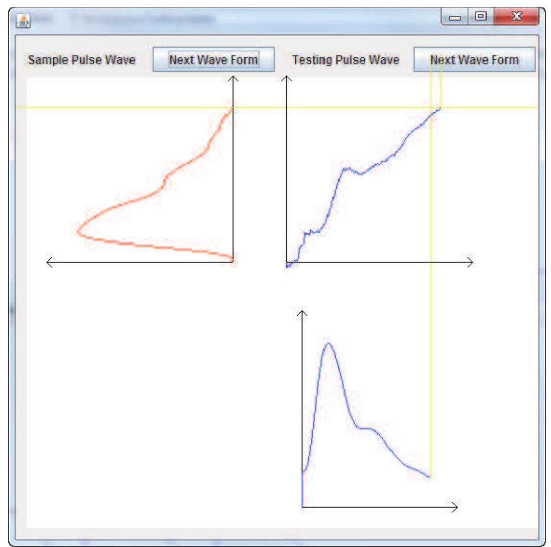 Demonstration for waveform difference comparison since pulse