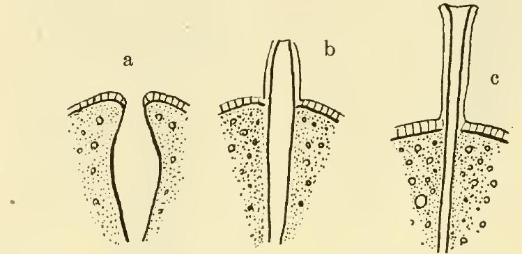 Diagrams showing the possible development of a suctorian