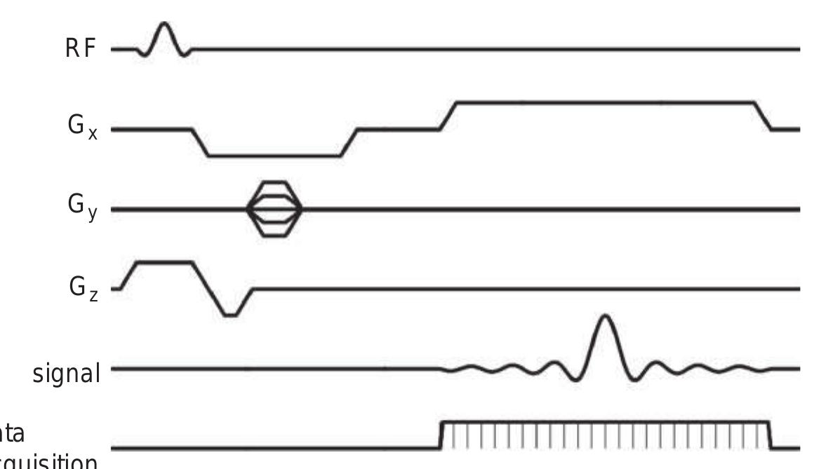 7. gradient echo imaging pulse sequence. each line shows the