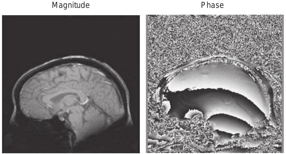 8. magnitude and phase images. an mr image reflects the