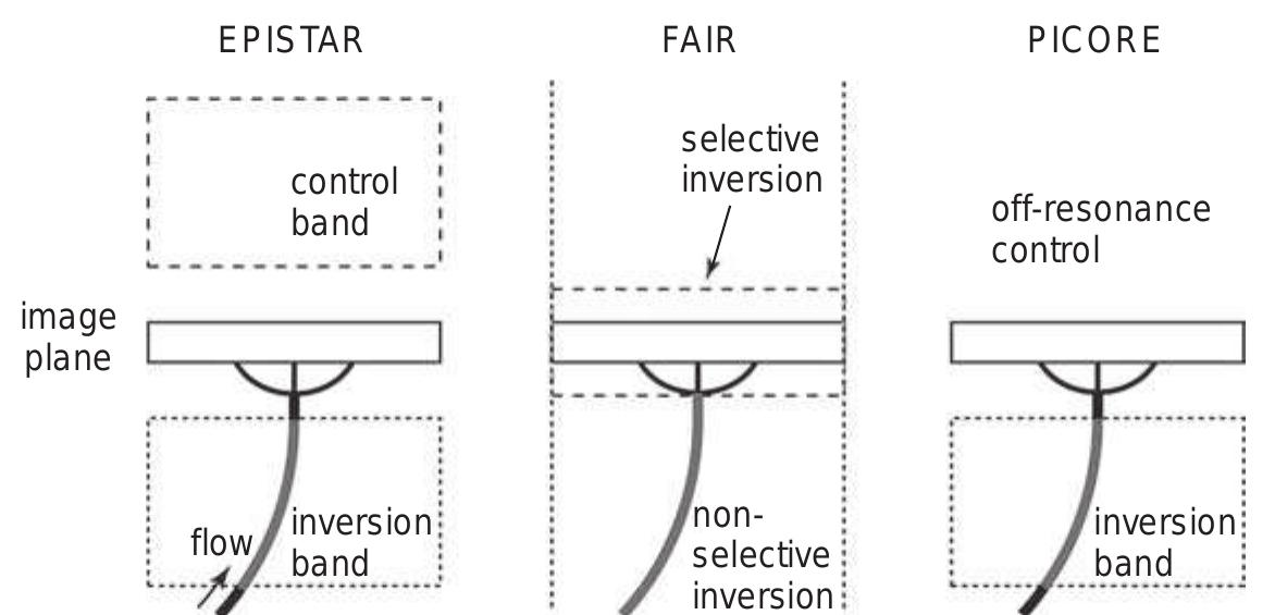 3. pulsed arterial spin labeling (pasl). arterial