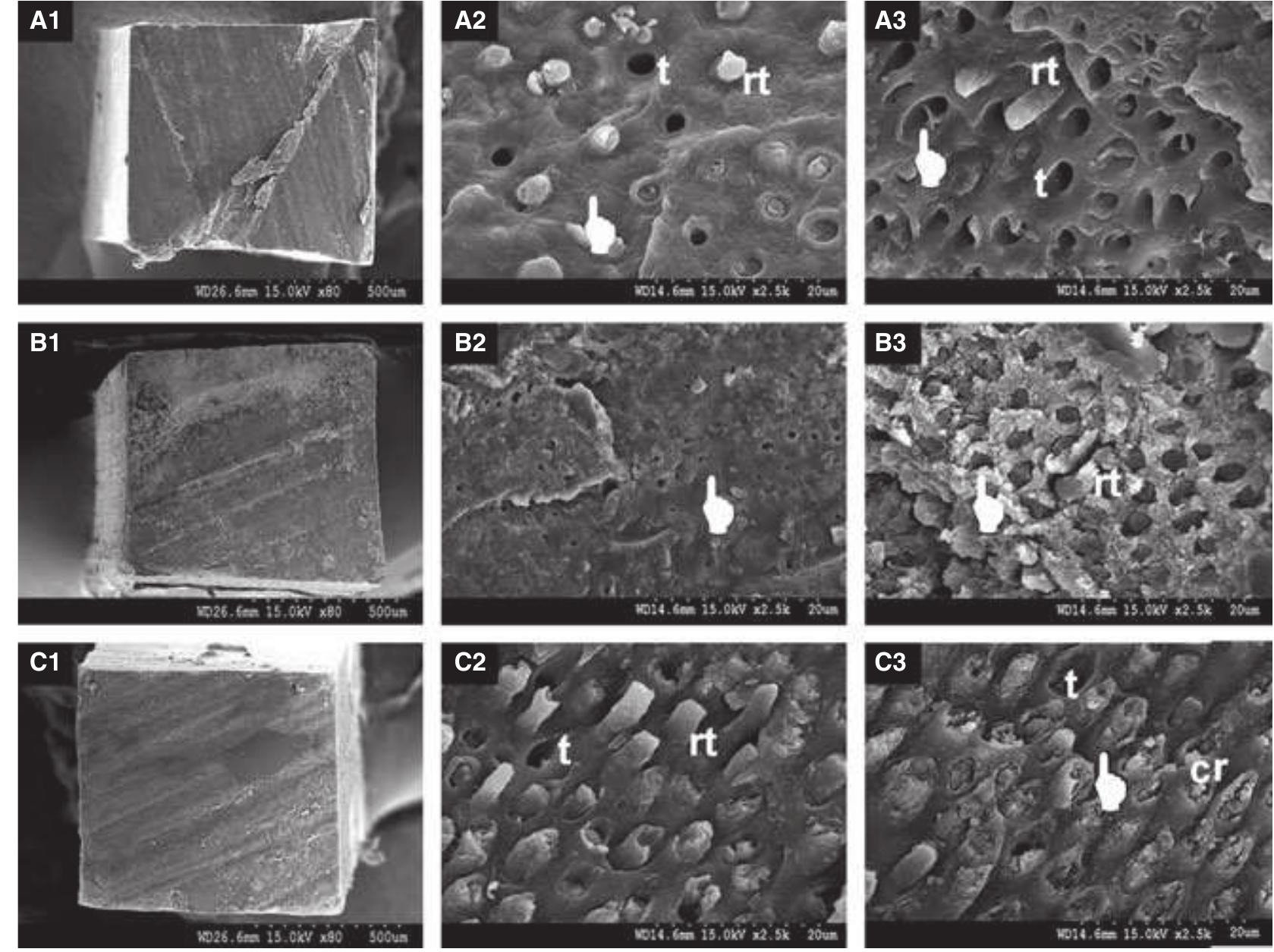 Scanning electron microscopy images of failure modes of the