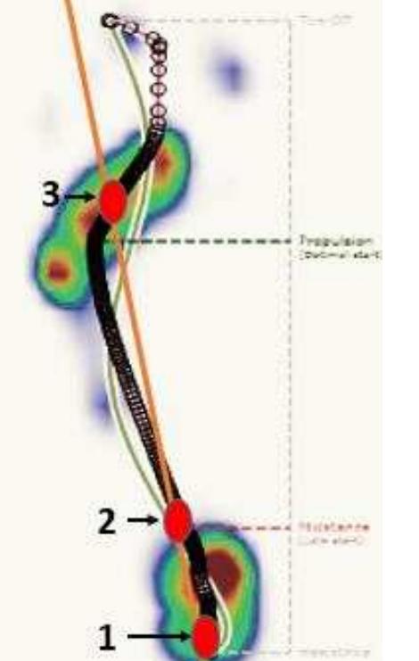Center of pressure gait line: aggregate of pressure dots