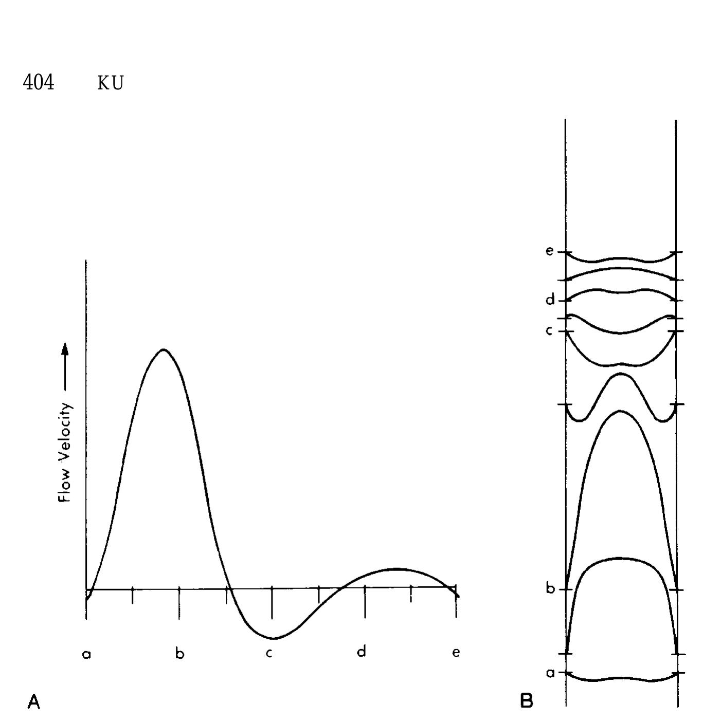 (a) flow velocity waveform in a normal femoral arterial