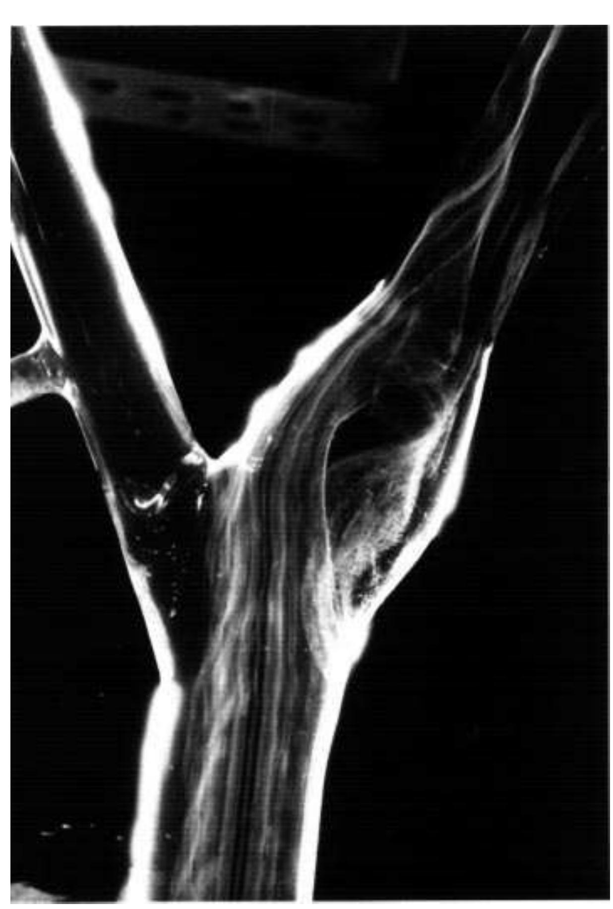 Hydrogen bubble visualization of flow through a model