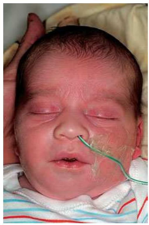 7b low frontal hairline is demonstrated. note also the sig-