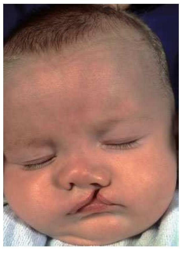 Figure 90 - The bedside dysmorphologist