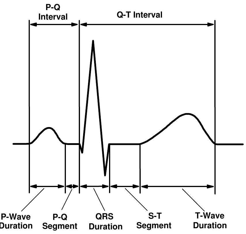 A typical ecg signal profile with timing of components