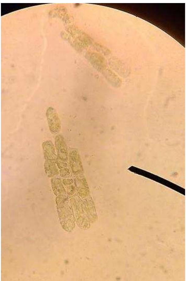 Pigments. but first, here is a photograph of the chloroplast
