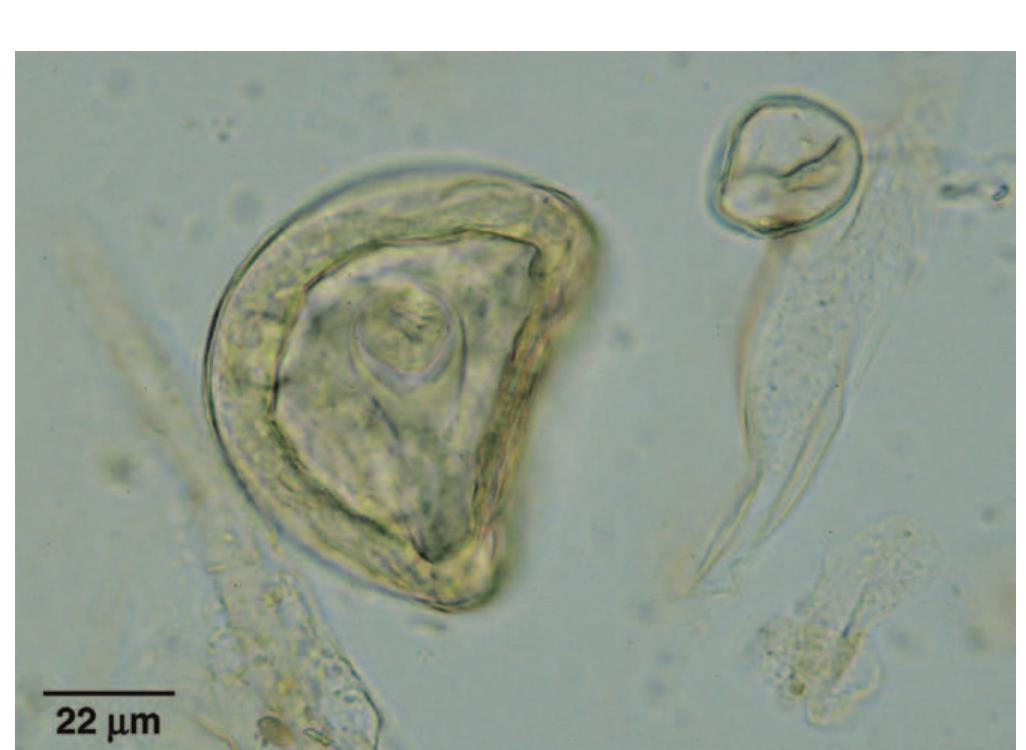 Ingestion of grain mite parasite location (adult)