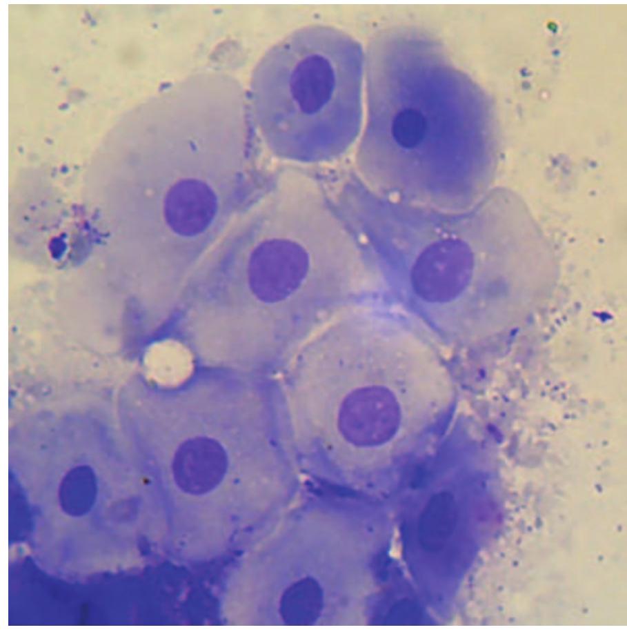 Ure 5.36 large intermediate vaginal epithelial cells.