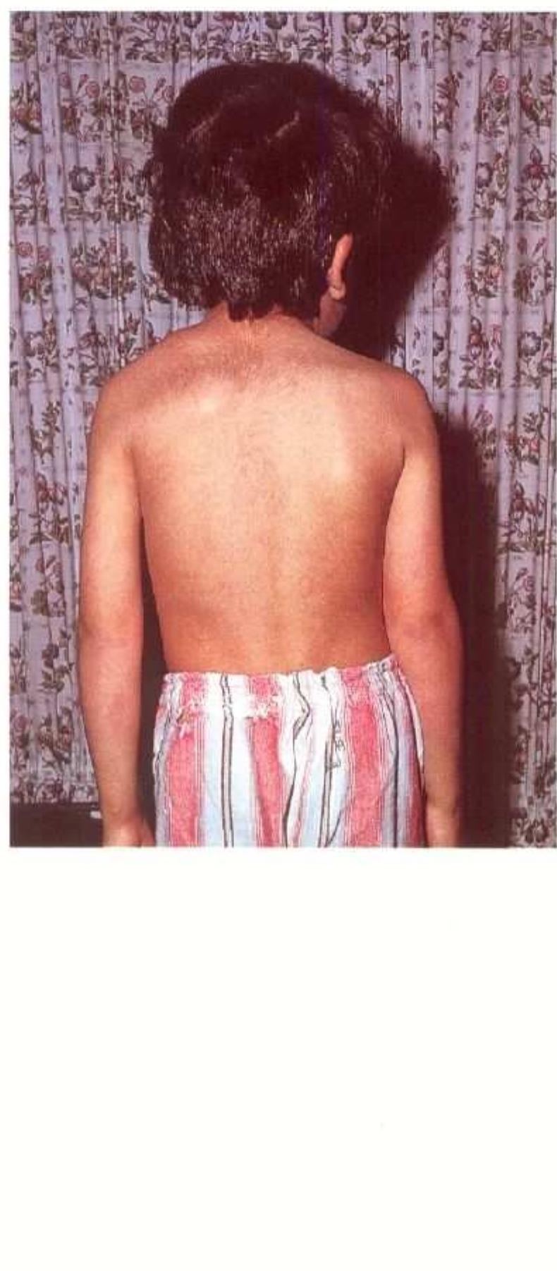 Figure 92 - Illustrated signs in clinical paediatrics