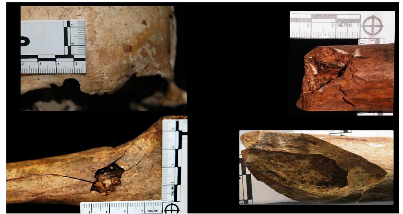 The study revealed high variety of types of lesions: on the