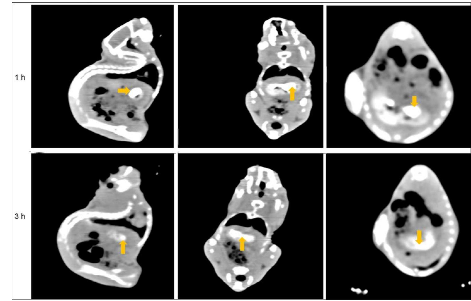 Ct images that show the sagittal, coronal, and axial views