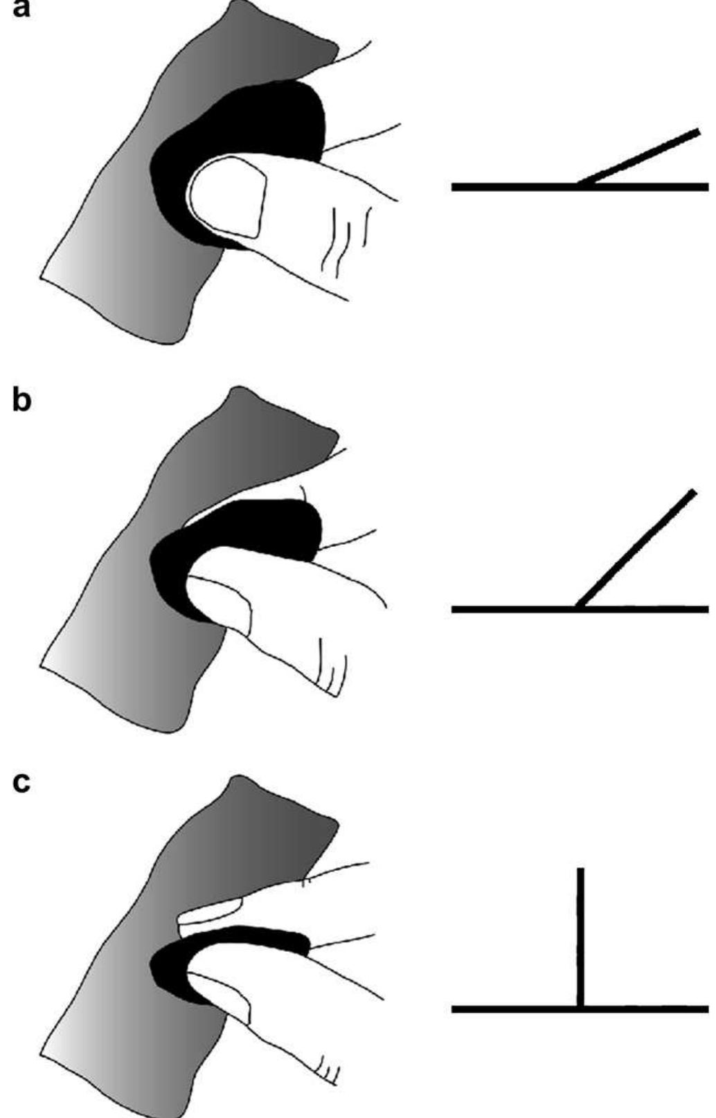 Angles of incision of both modern metal knife and the modern
