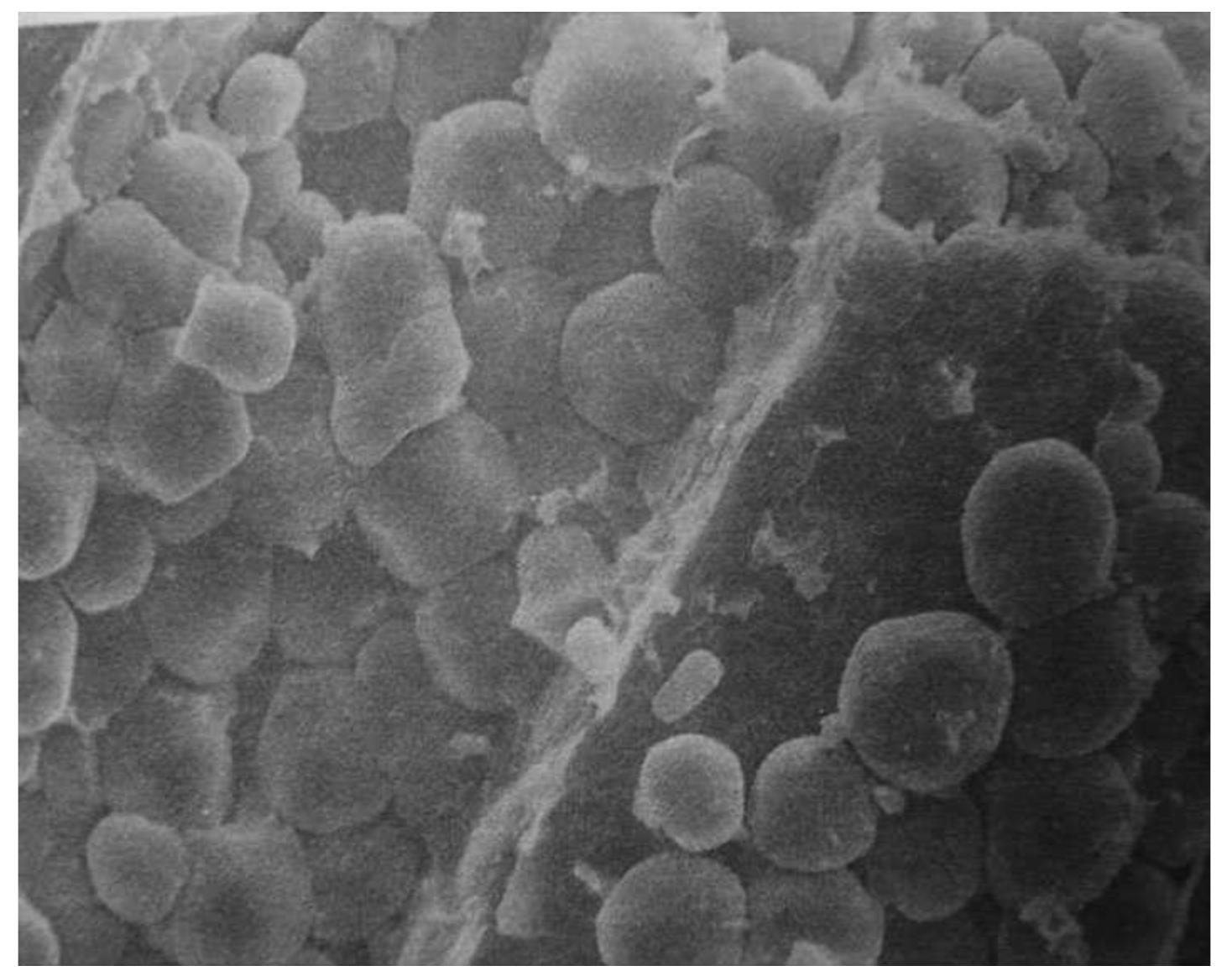 47. scanning electron microscope micrograph of grain