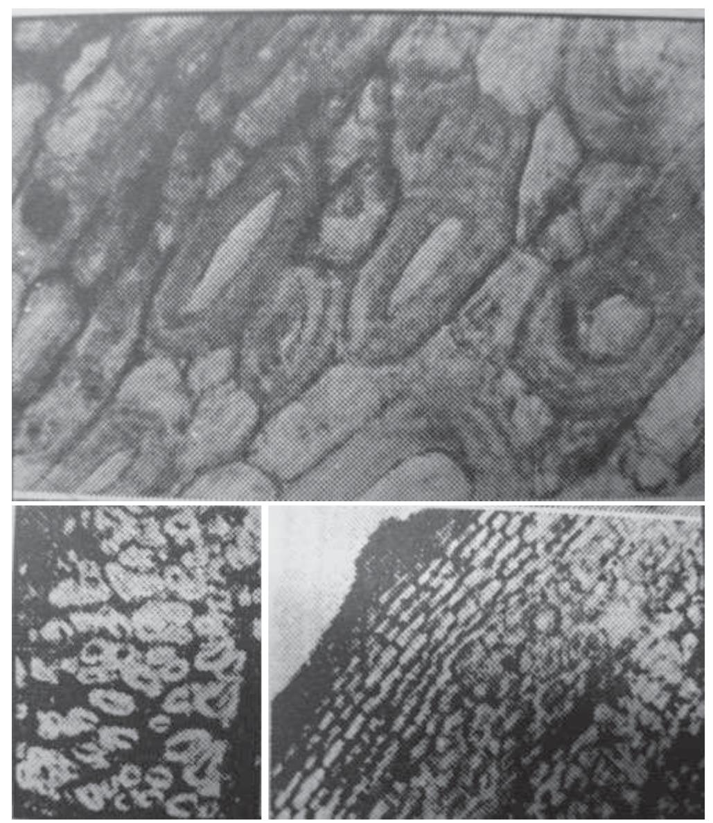 41. transverse sections of ramie stem showing the
