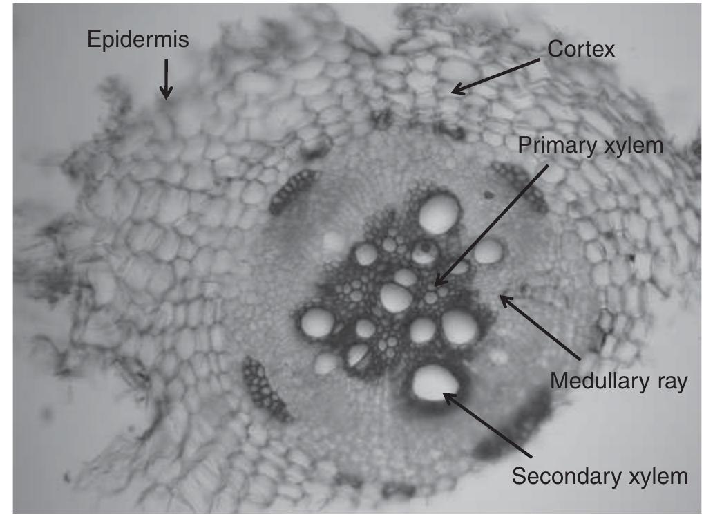 35. transverse section of root (100x) showing epidermis,