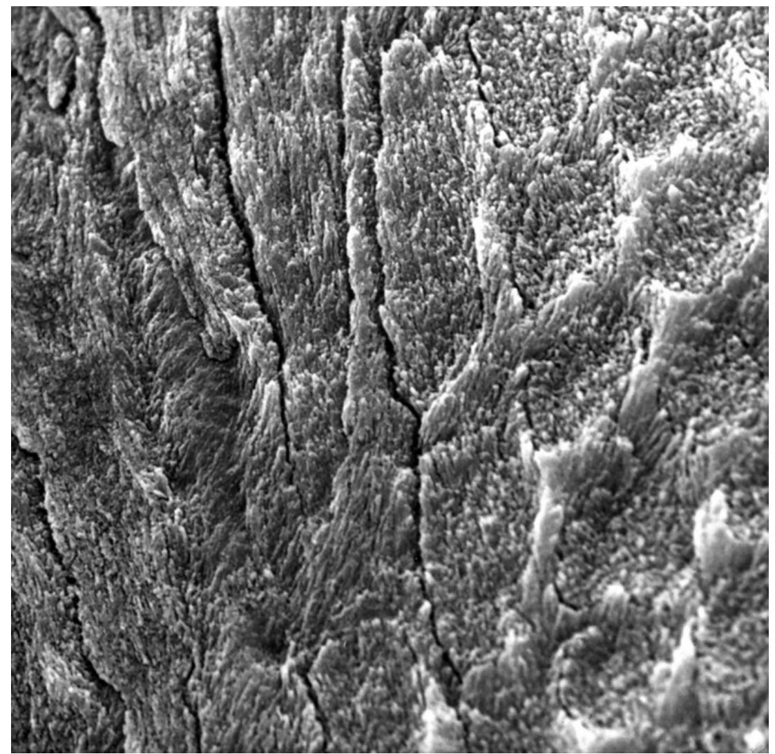 6. scanning electron microscope image of the dental enamel