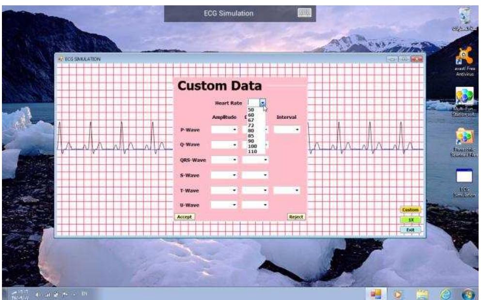 Figure 19 - ECG Simulation using Fourier Series: From