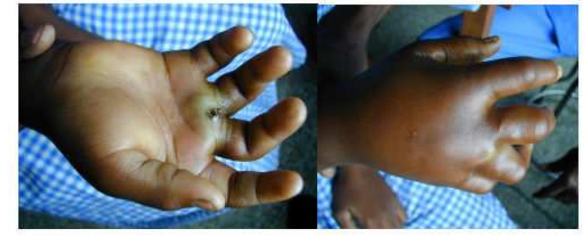 Appendix c: the seven wound exemplars a young man has come