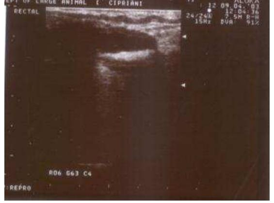 Figure 29 - from ULTRASOUND OF THE ABDOMEN IN THE ADULT
