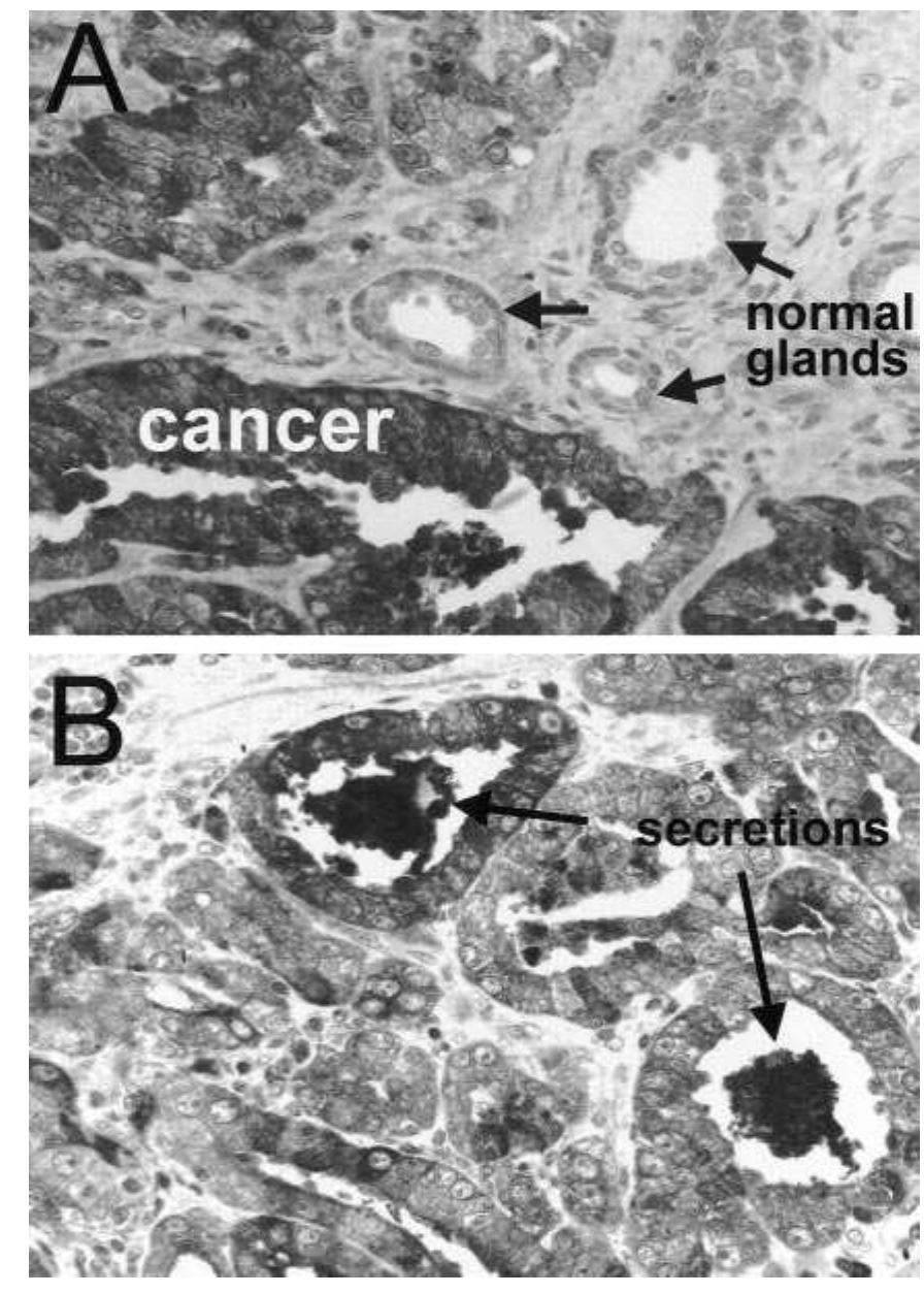 Immunohistochemical staining of prostate tissues for
