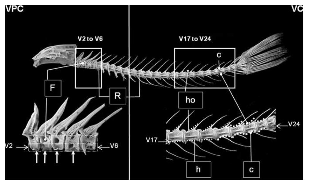 Argyrosomus regius brain case (neurocranium) and vertebral
