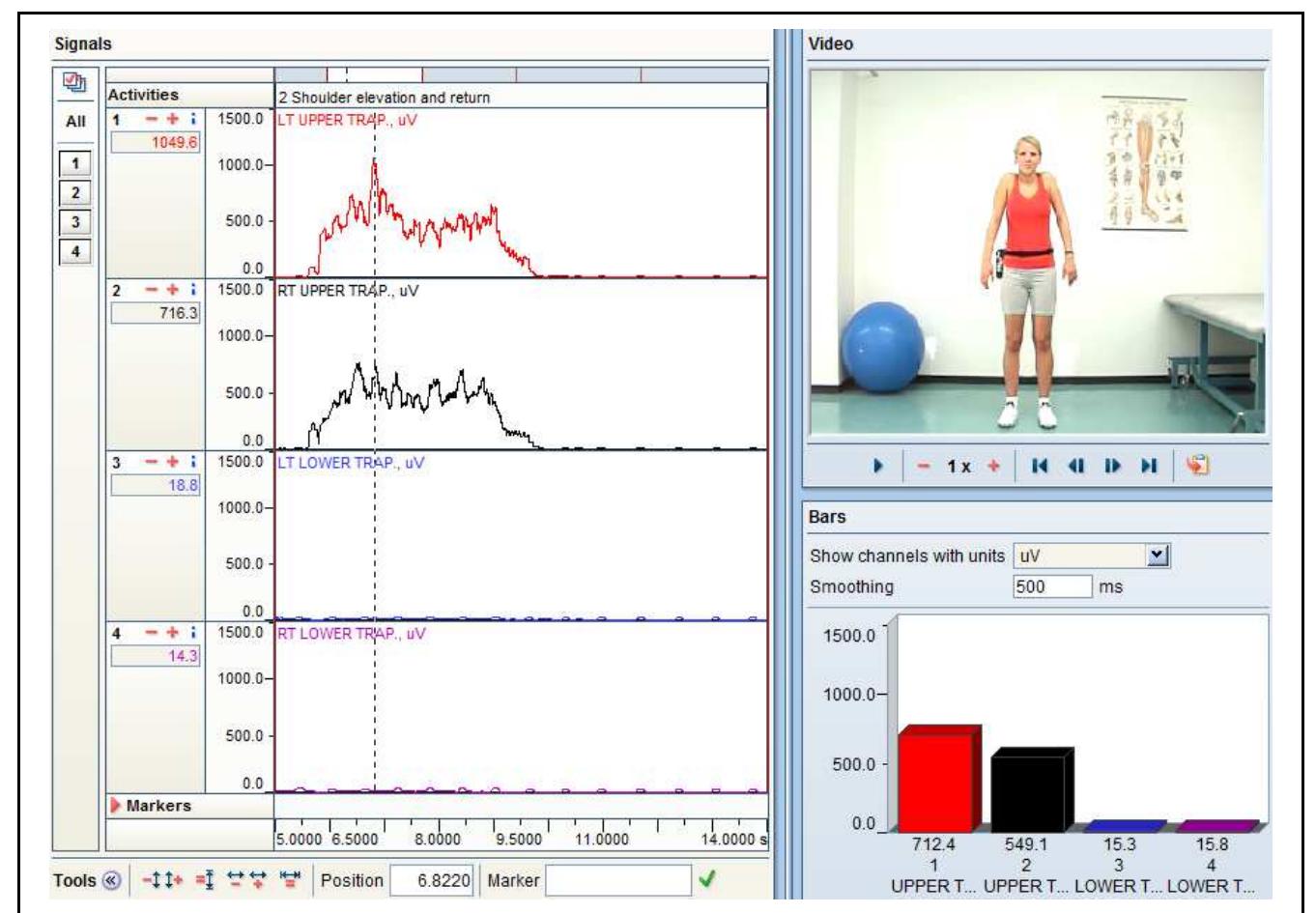 Phase 3 - bilateral shoulder flexion and return to neutral