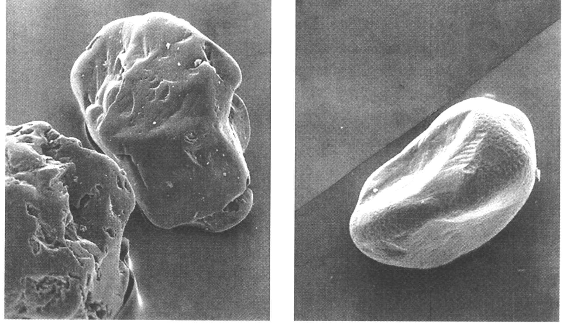7 scanning electron micrographs of quartz sand grains *rom