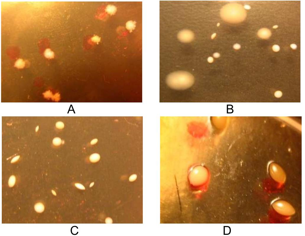 The colony morphology of lactobacillus acidophilus la-5 and