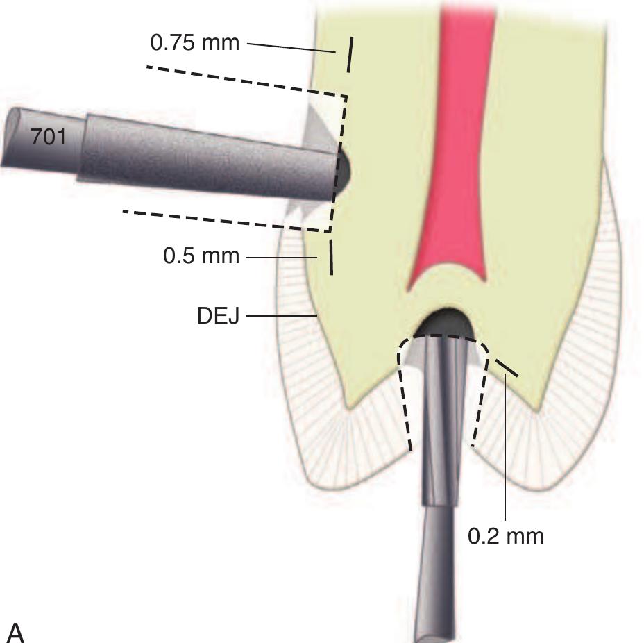 (PDF) STURDEVANT'S ART AND SCIENCE OF OPERATIVE DENTISTRY - SOUTH ASIAN ...