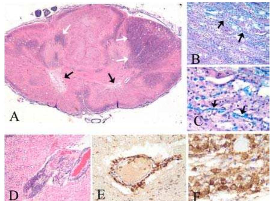 Histology of tm. a: myelin staining of cervical spinal cord