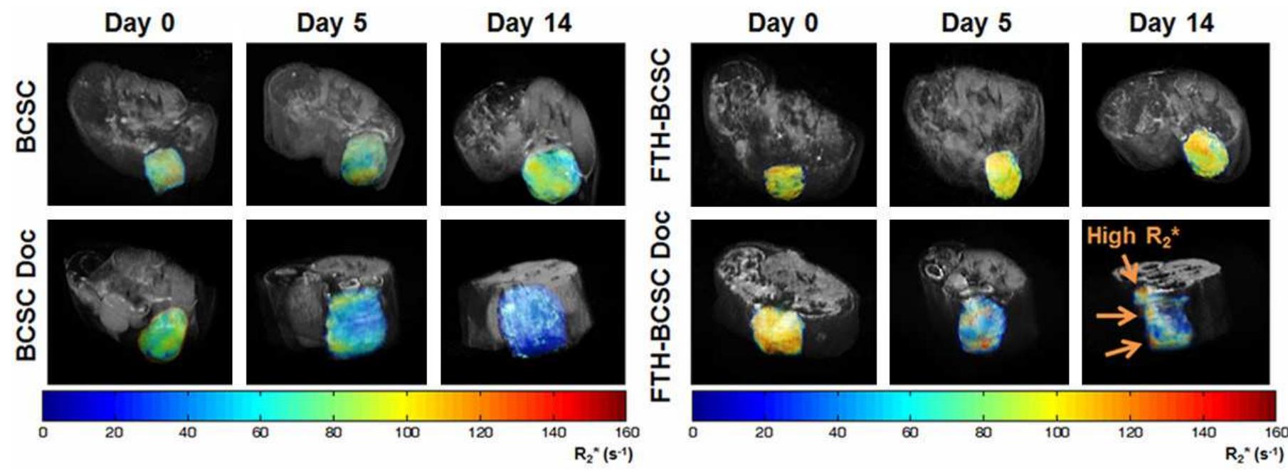 Follow-up volumetric mri images of bcsc, bcsc treated with